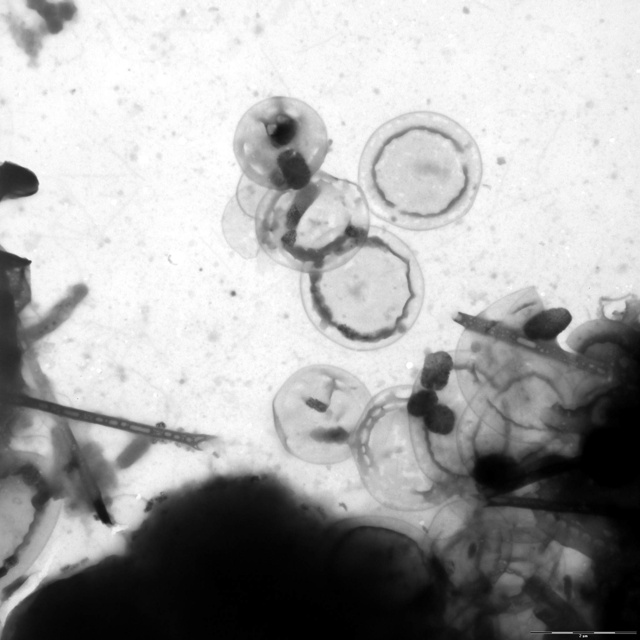 Chrysosphaerella rotundata | Silica-scaled chrysophytes of Europe